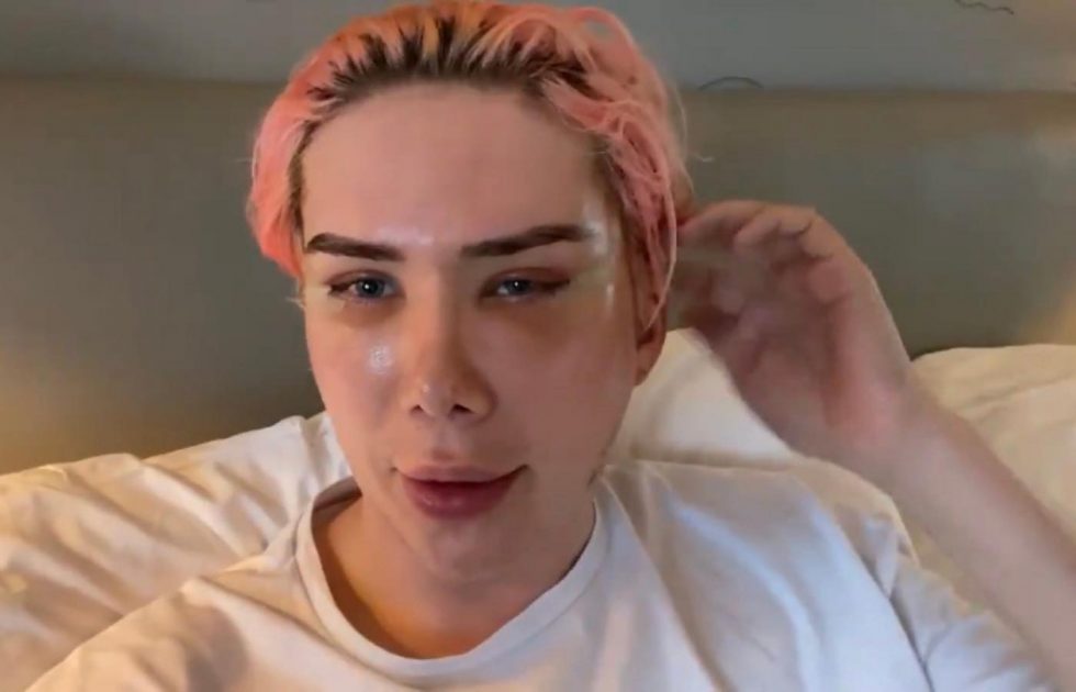 Social Media Star Oli London Gets Plastic Surgery to "Become Korean" to ...